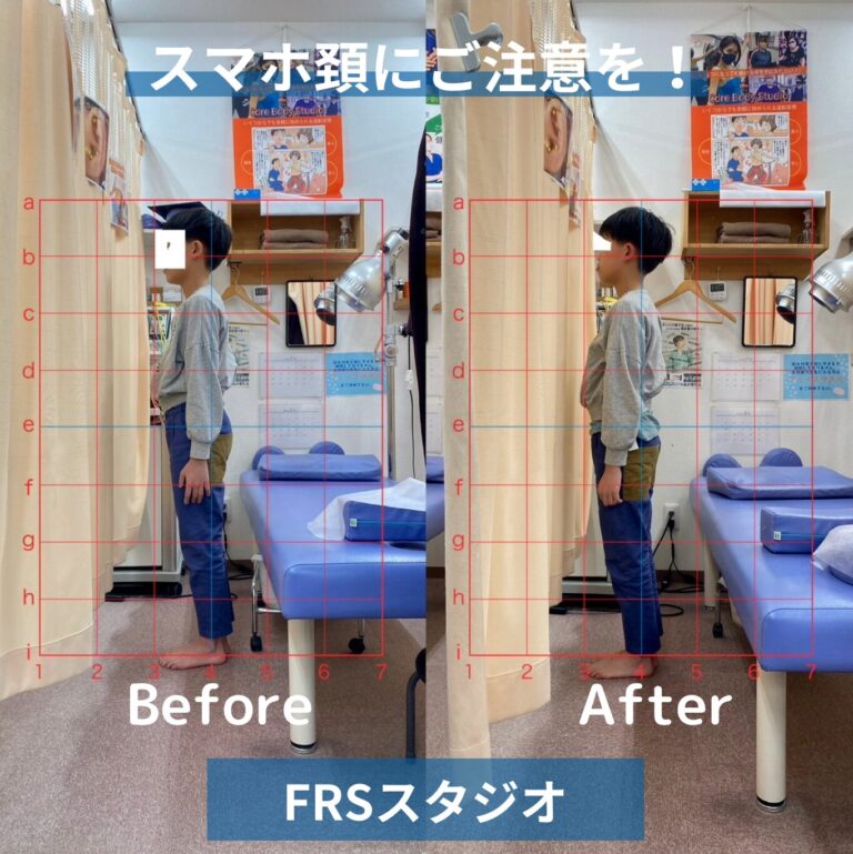 流行中のスマホ首にご注意ください！ | 筋膜整体リリースXストレッチFRSスタジオ